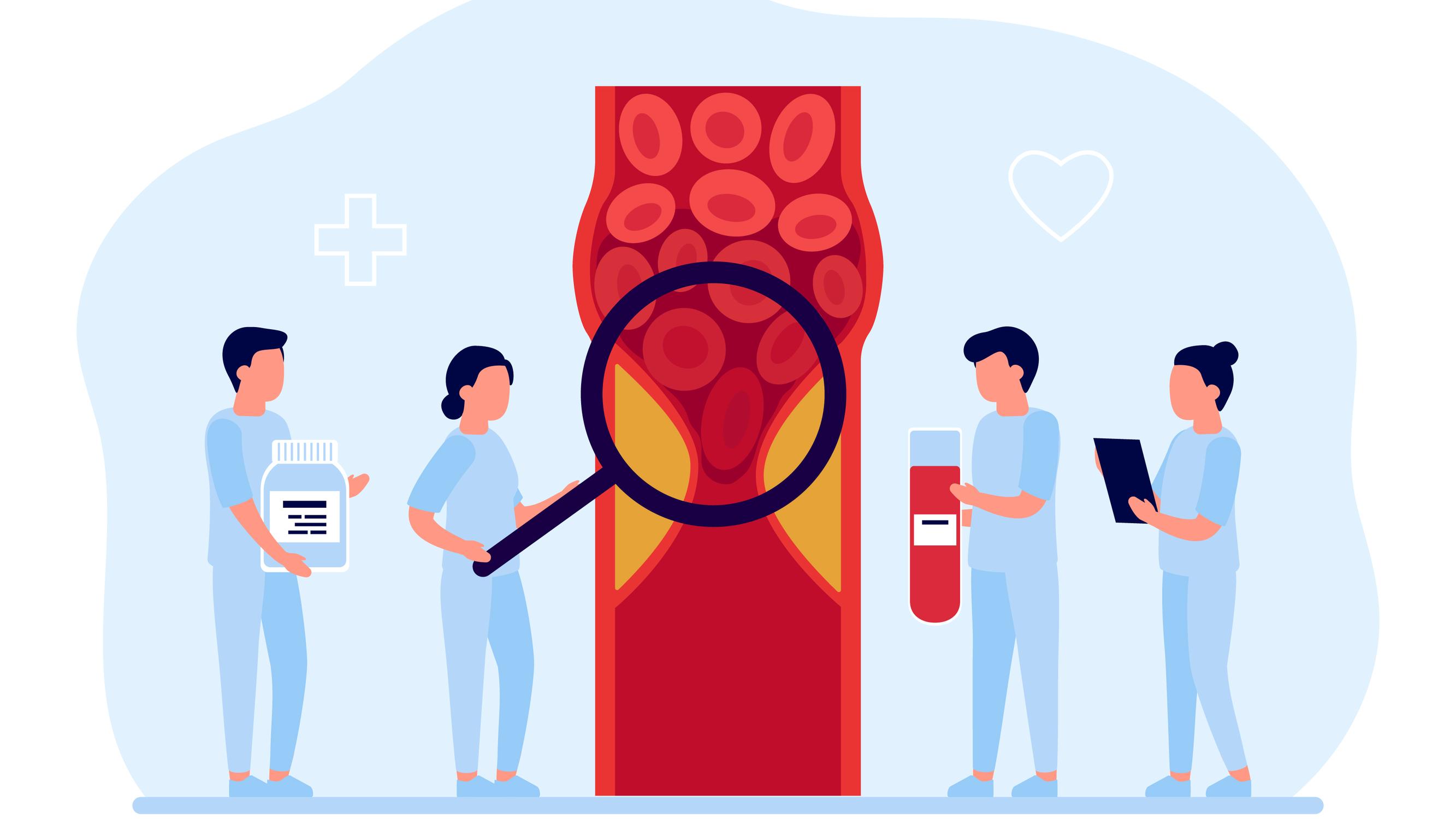 Laskimotukos | Näin tunnistat oireet ja ehkäiset | Viisi vinkkiä | Apu