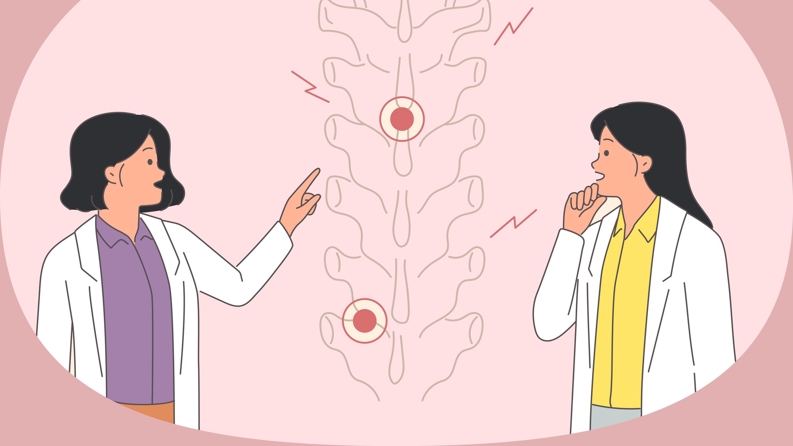 Voiko selkärangan ahtauma tai laskeuma johtaa ulosteenkarkailuun? | Apu