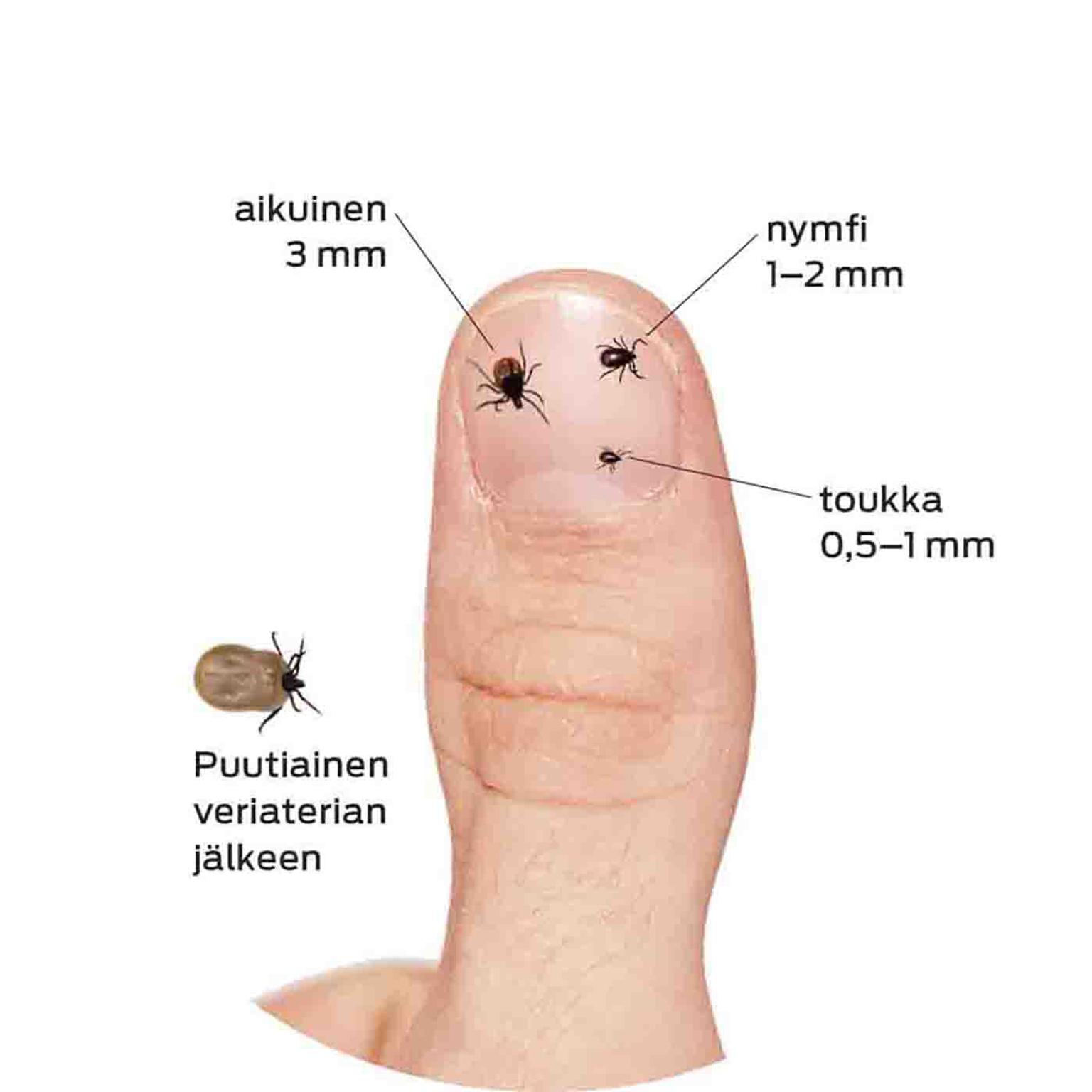 Punkit – ehkäise ennalta ja suojaudu taudeilta: 9 faktaa | Apu
