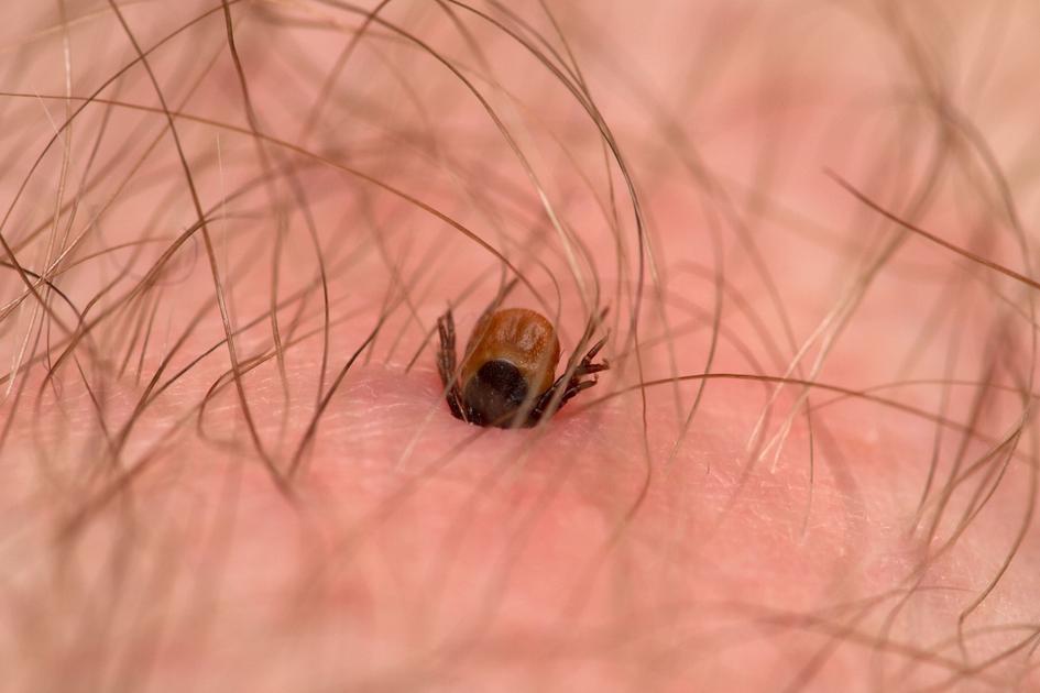 Punkkikausi alkaa – 7 vinkkiä | Apu