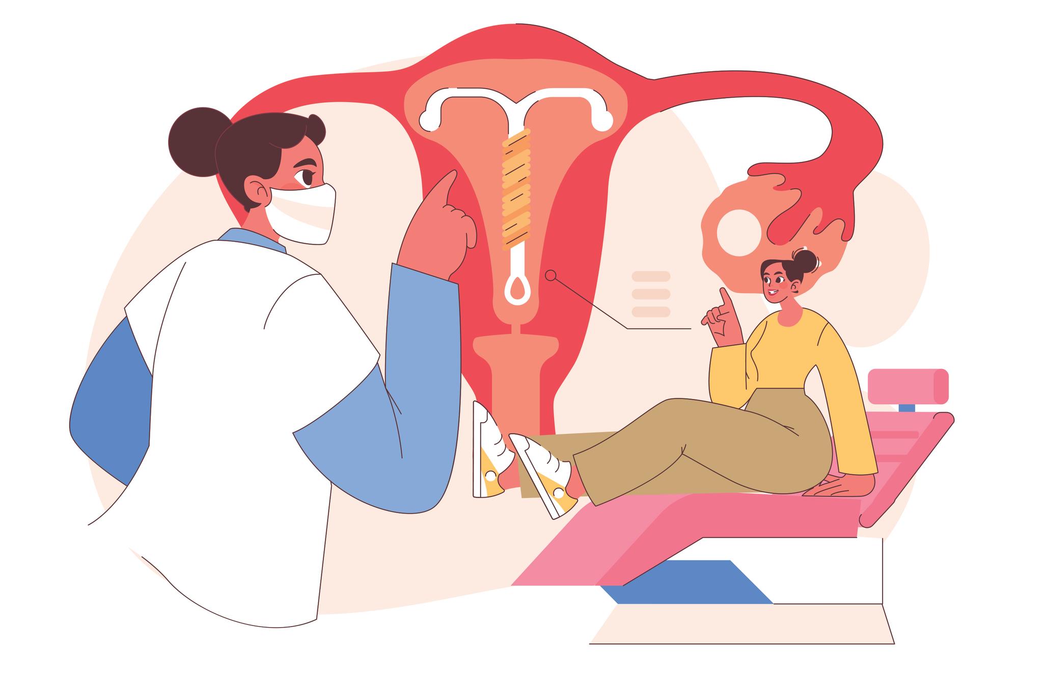 Hormonikierukka | Lopettaako se vuodot kokonaan? | Kuukautiset | Apu