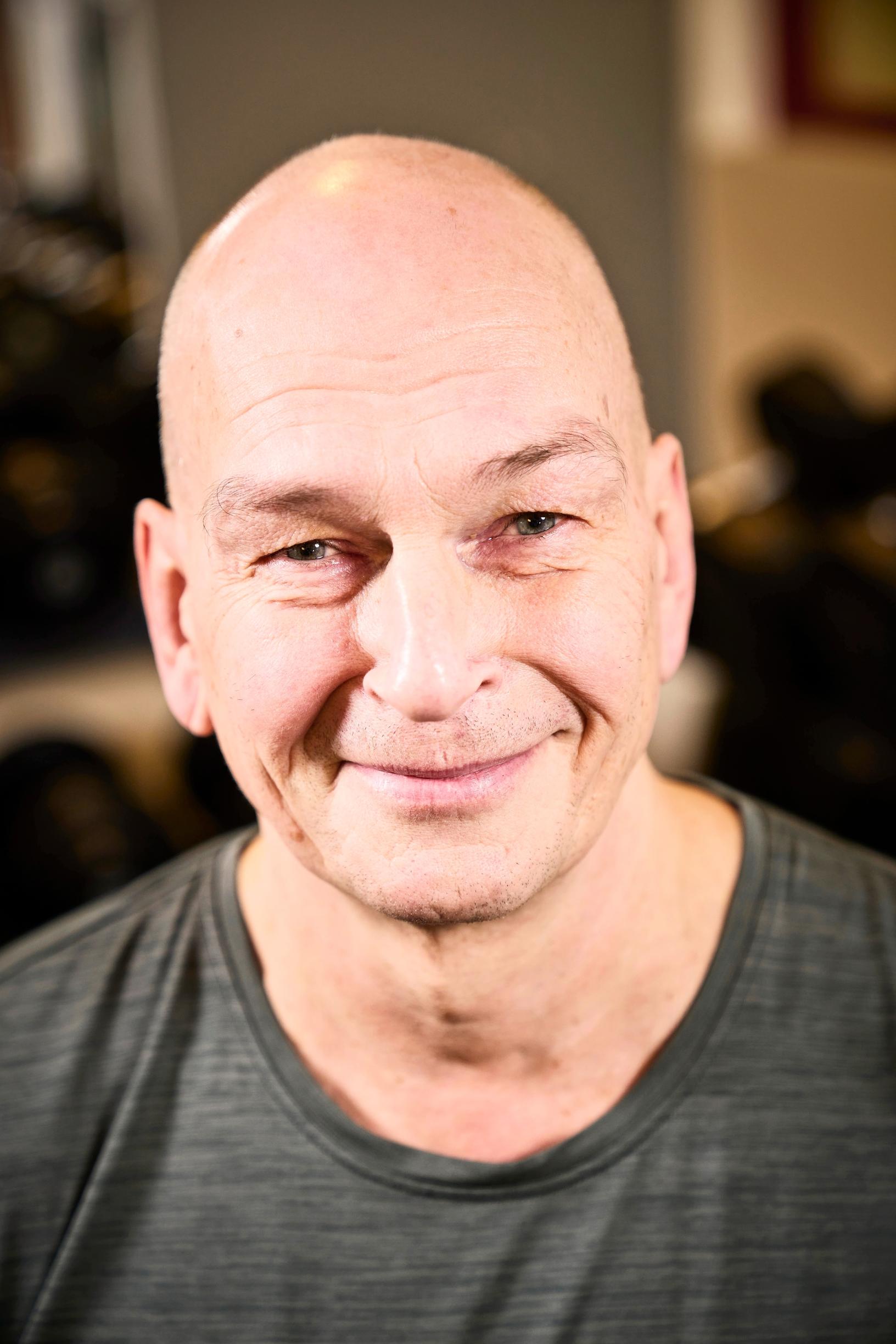 Amputoitu jalat ja sormet, mutta rauta nousee | Selviytymistarina | Apu ...