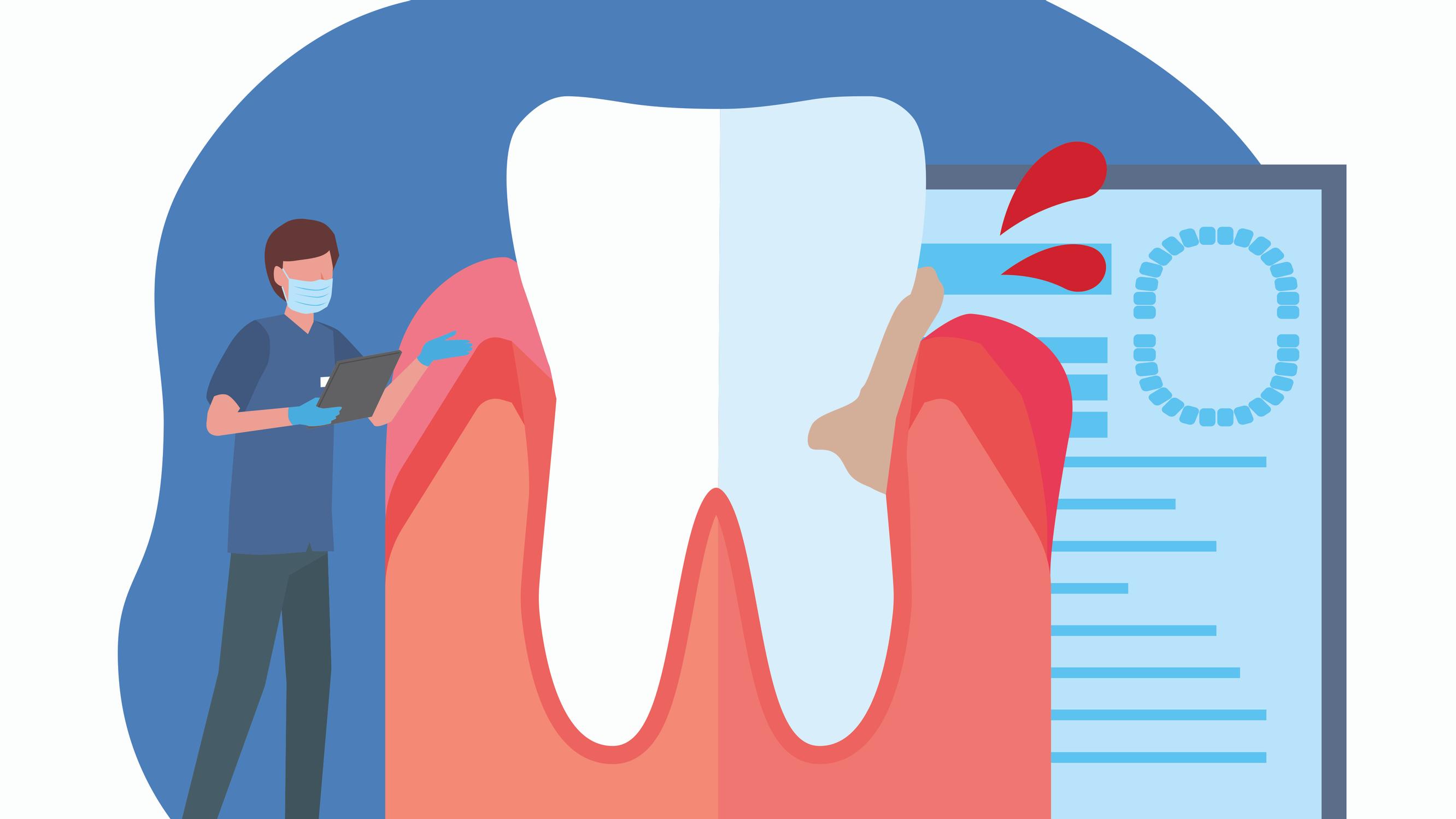 Ientulehdus | Eroon verta vuotavista ikenistä | Viisi vinkkiä | Apu