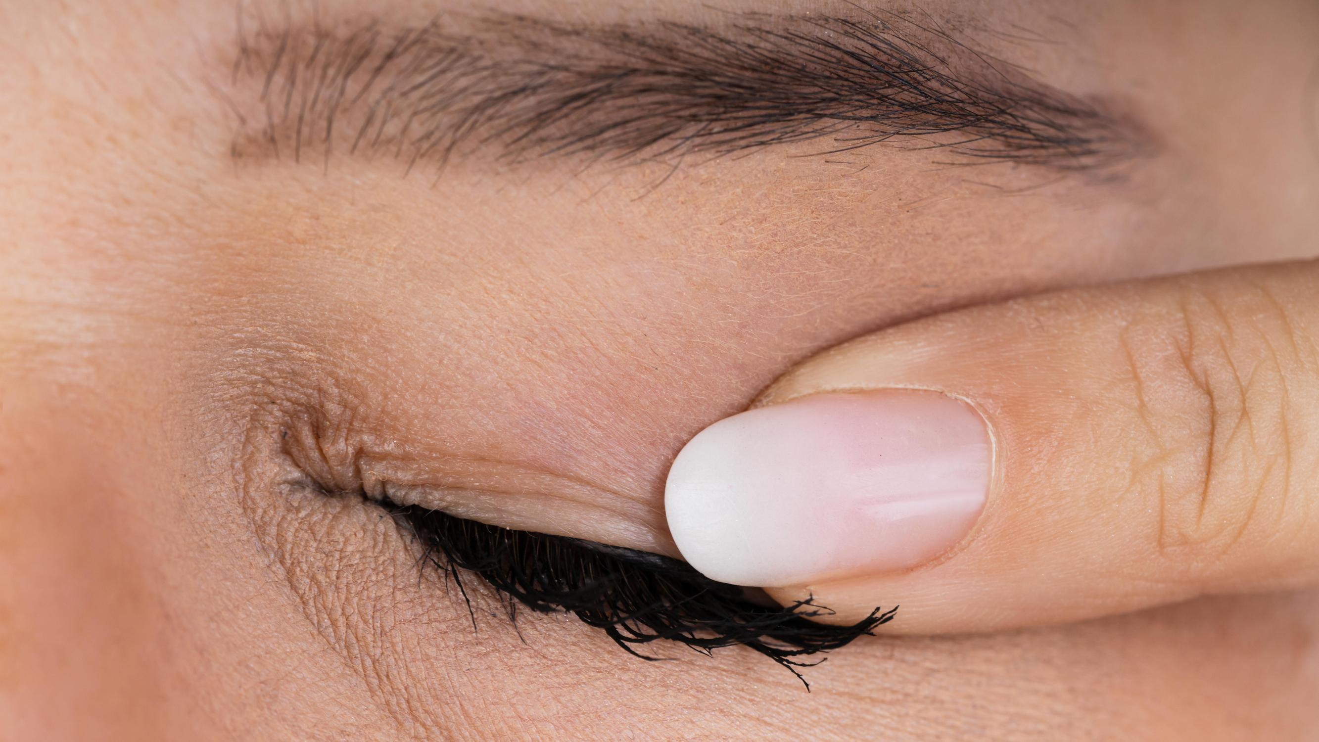 Silmässä lentää roskia ja samentuma | Apu-klinikka | Apu